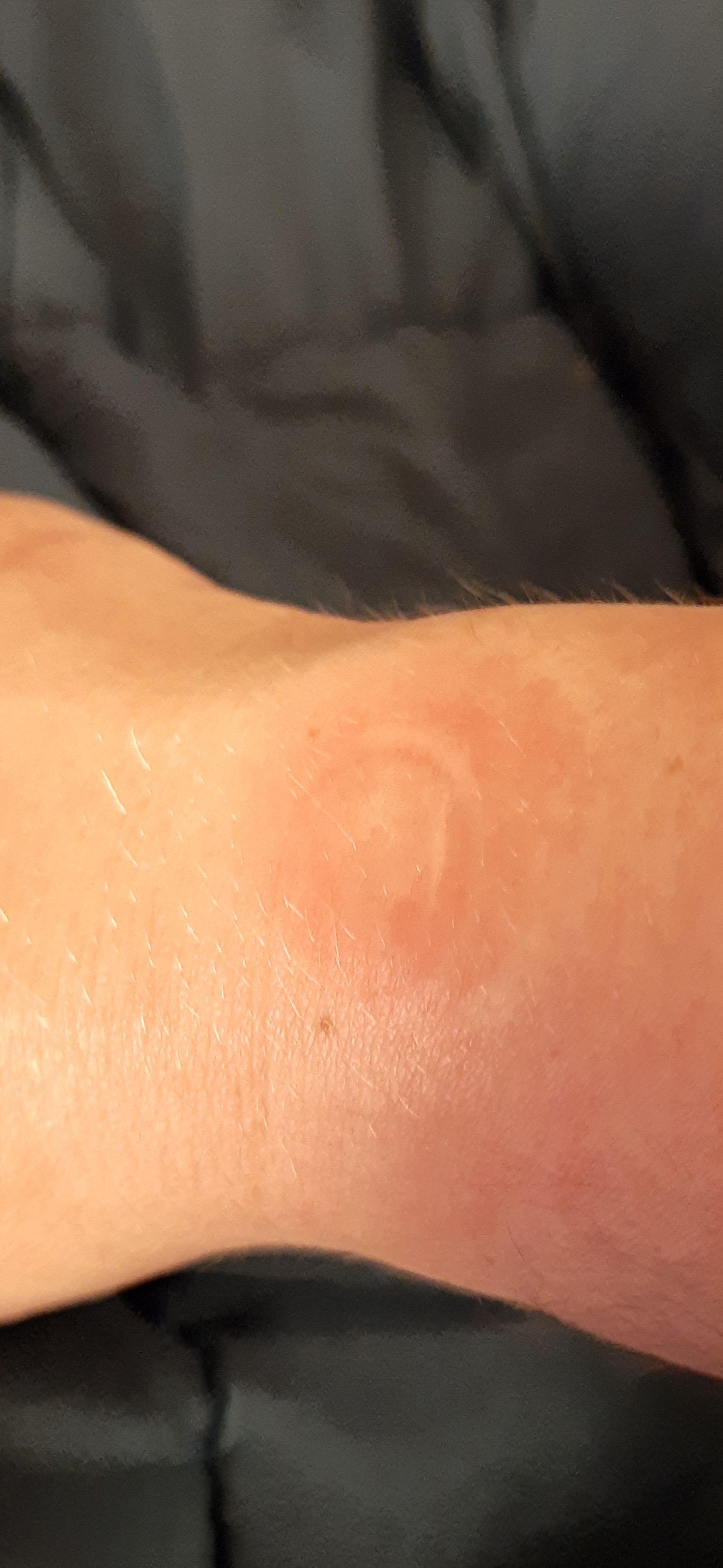 Rash Galaxy 42mm Watch - Samsung Community