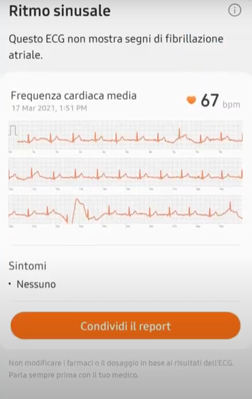 ECG orologi - Samsung Community