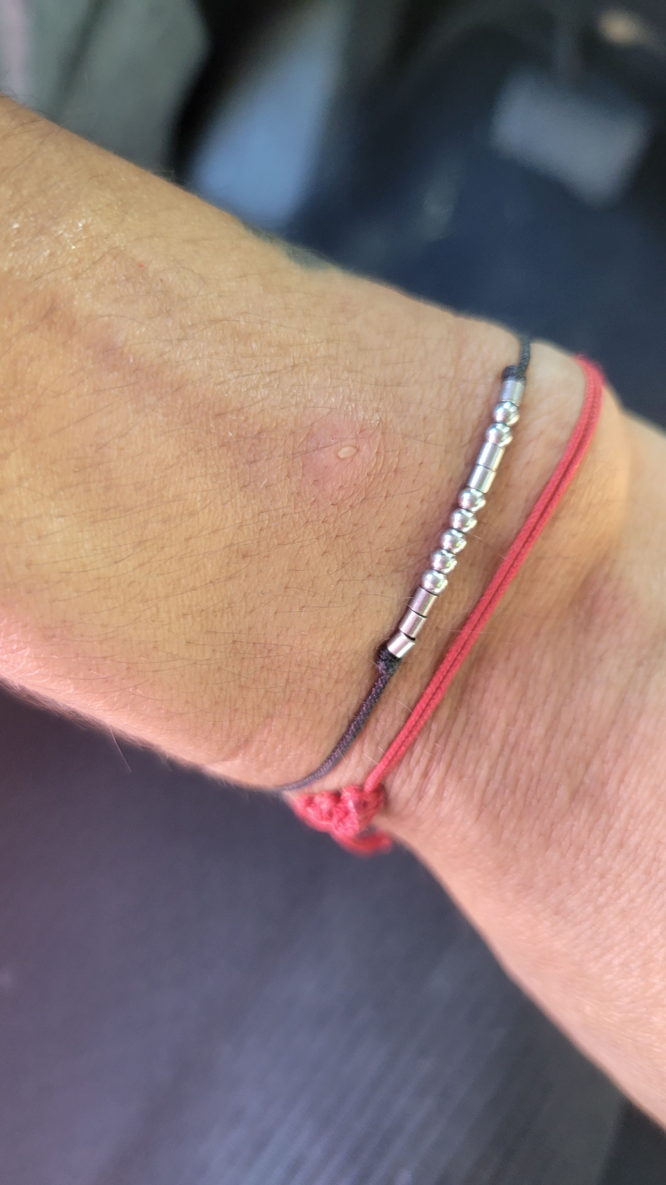 Burnt by Galaxy watch4 - Samsung Community