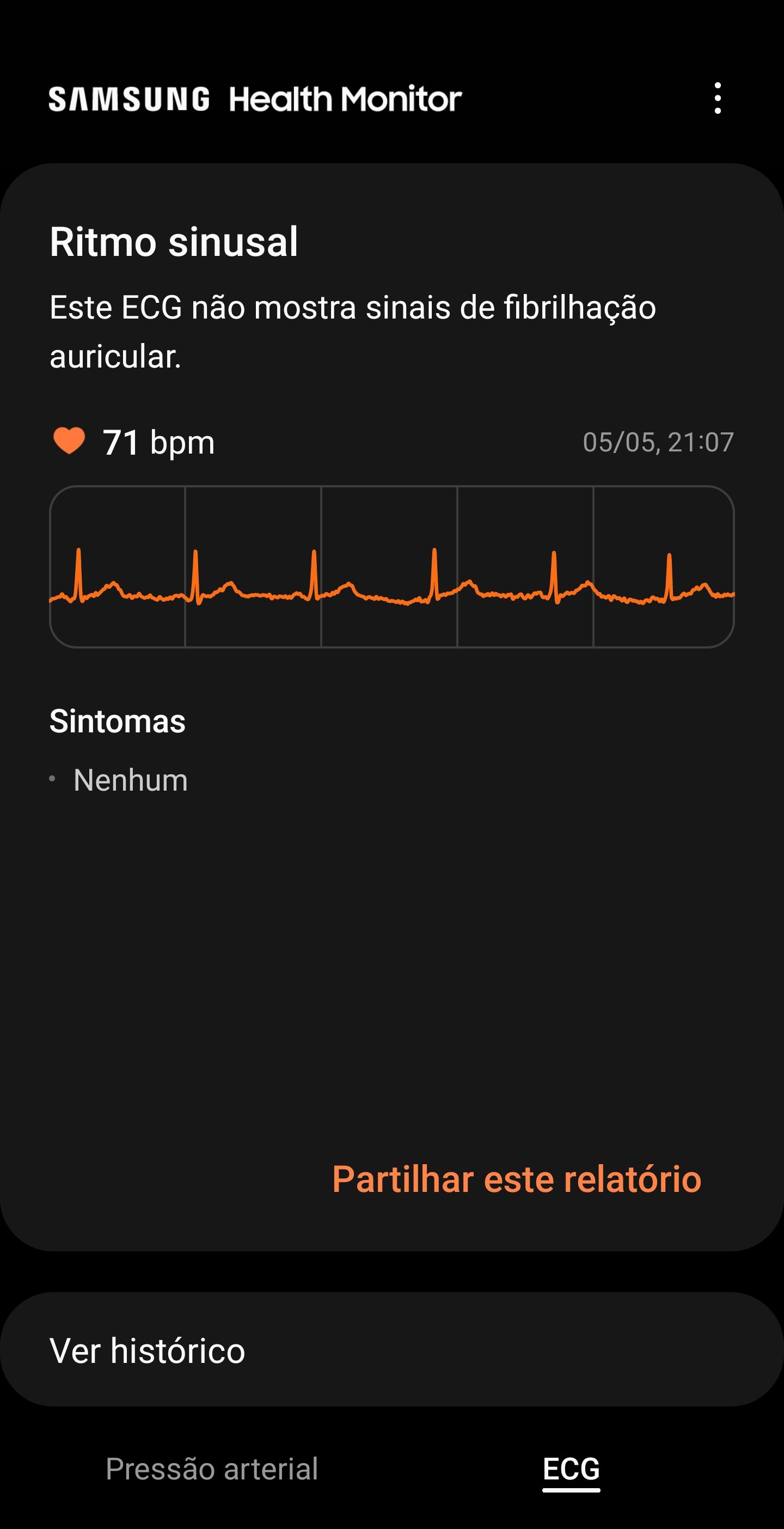 ECG watch 5 pro - Samsung Community