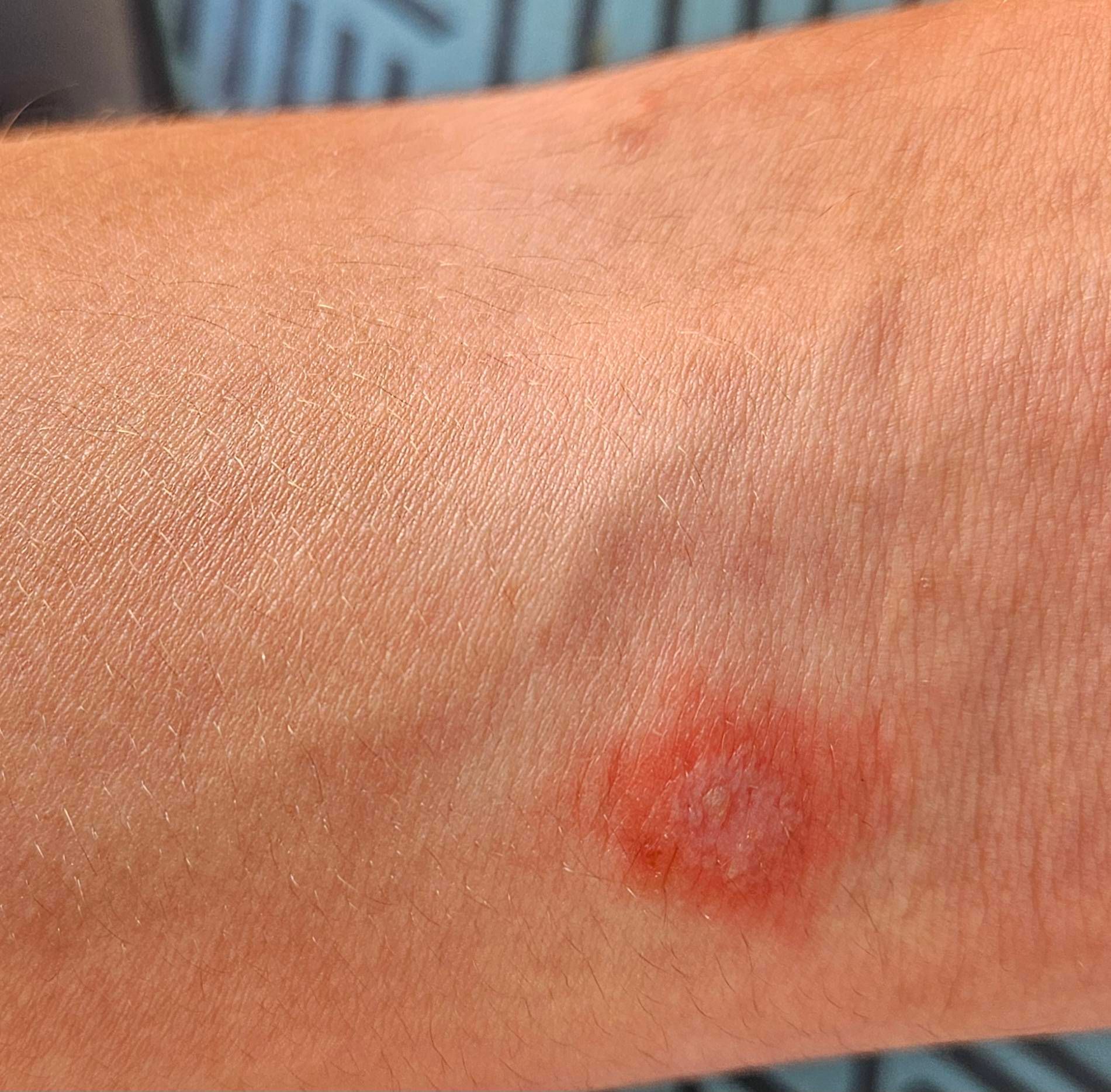 Demande de dédommagement viable? - Samsung Community