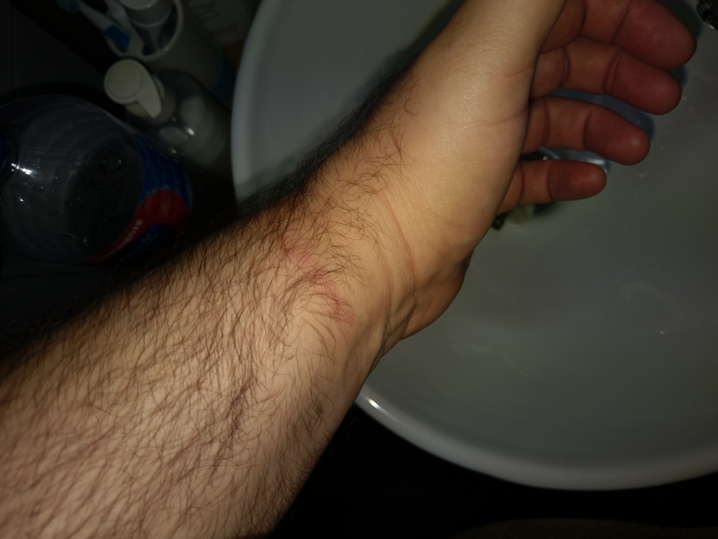 Galaxy watch rash - Samsung Community