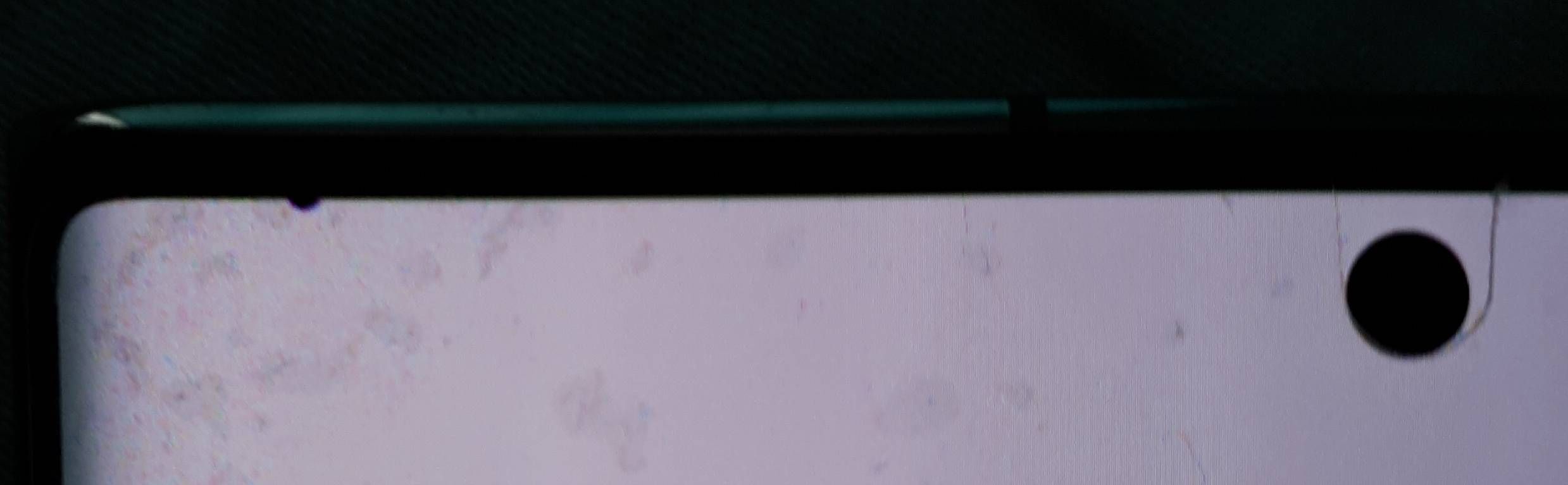 Gelöst: Schwarzer Punkt - Samsung Community