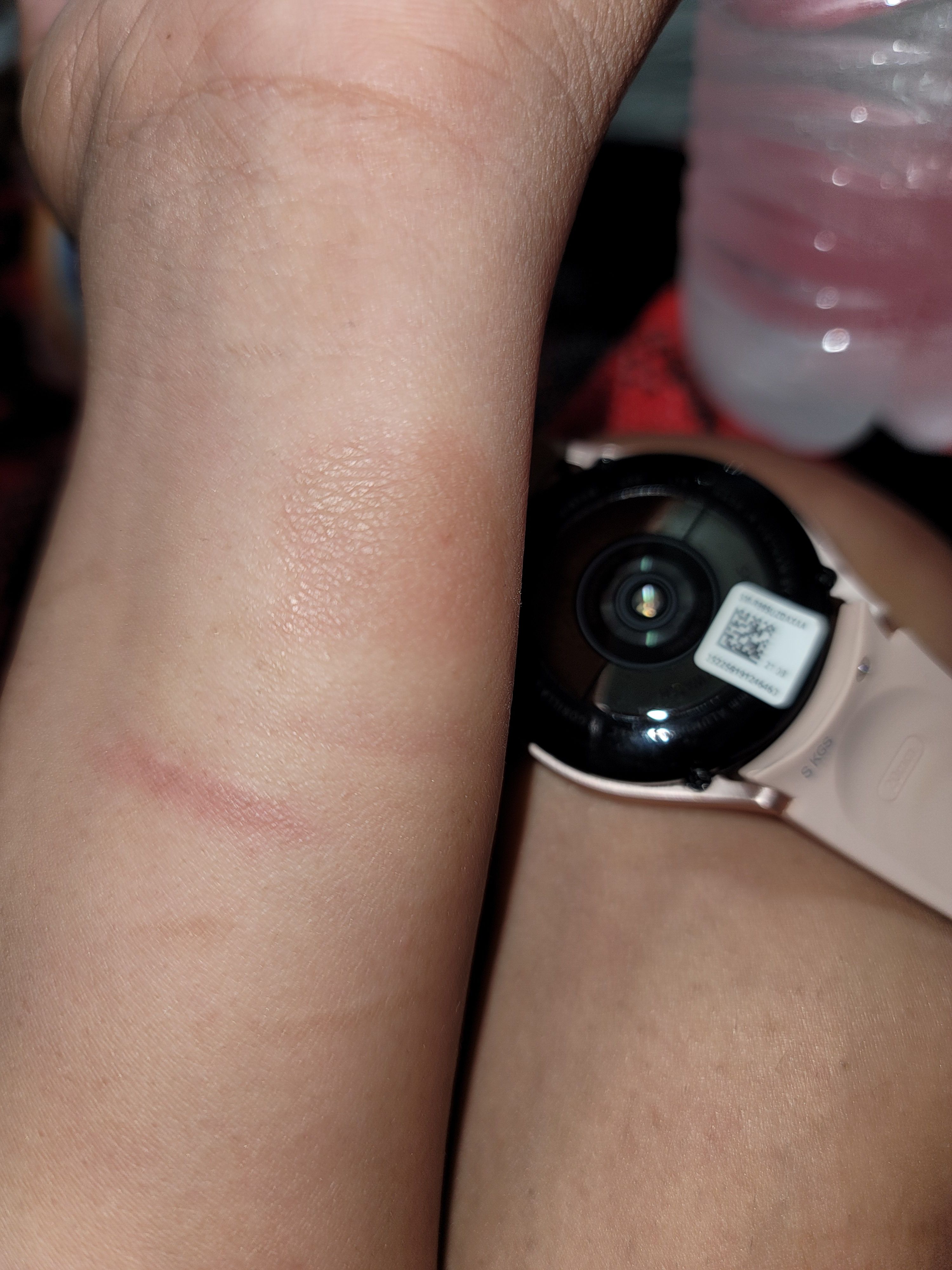 Solved: Samsung watch 4 - marks on my arm where the watch was - Samsung ...