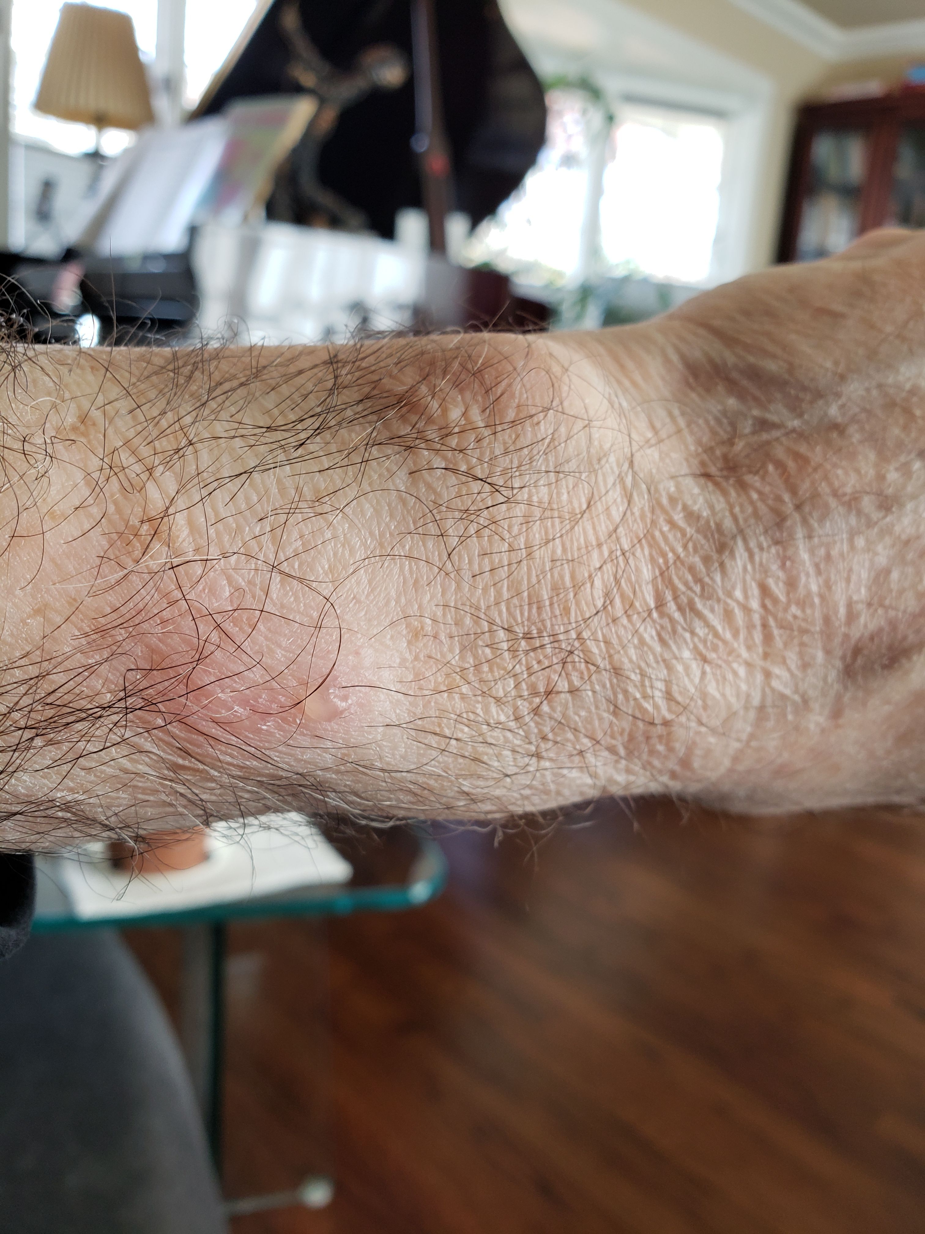 Samsung Watch 4 Classic Burning My Wrist - Samsung Community