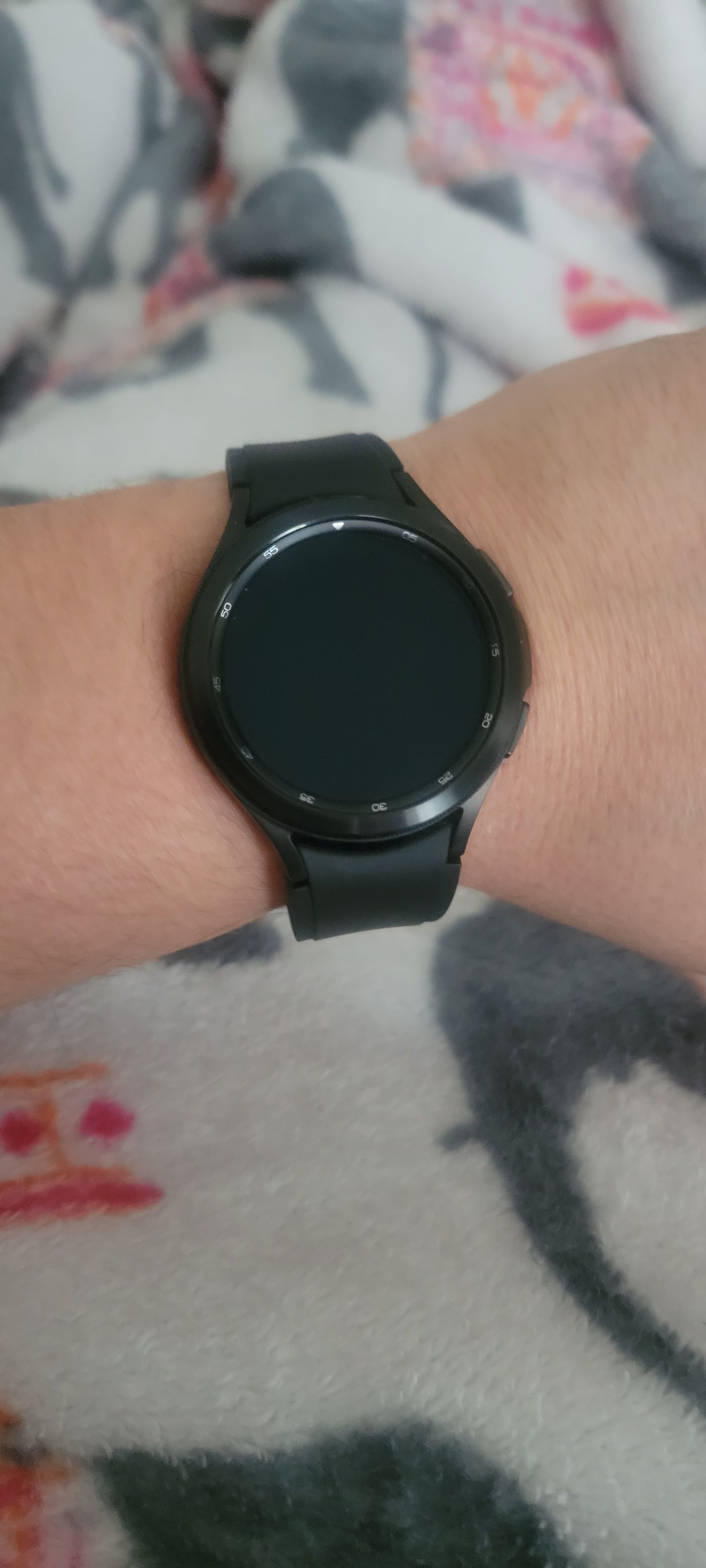 Galaxy watch classic wrist burn - Samsung Community